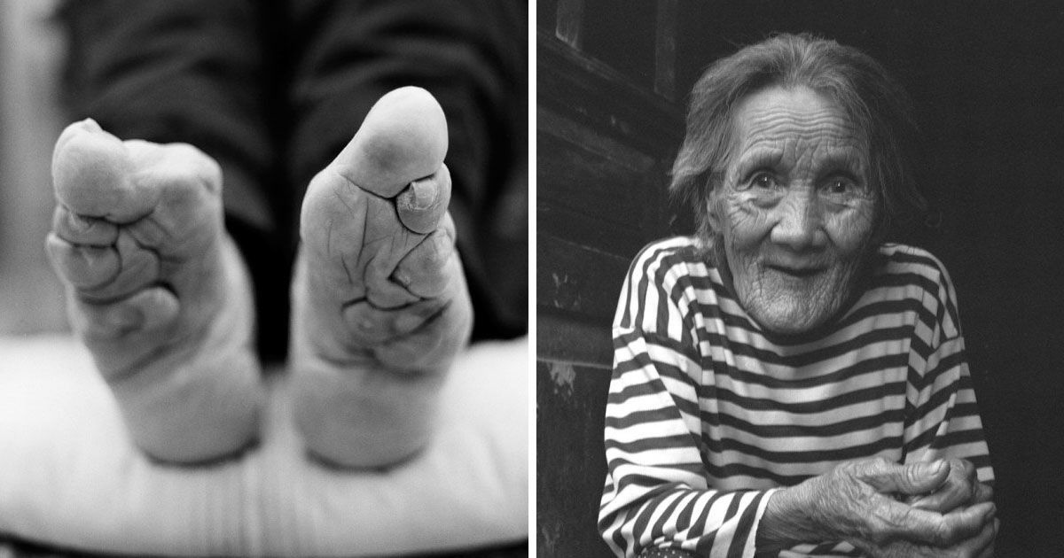 10 foto delle ultime donne cinesi con i piedi fasciati