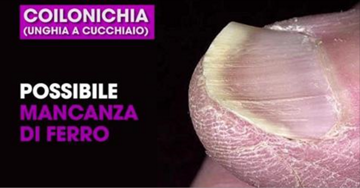 Le unghie possono dirci molto sulla salute del nostro organismo - Page ...