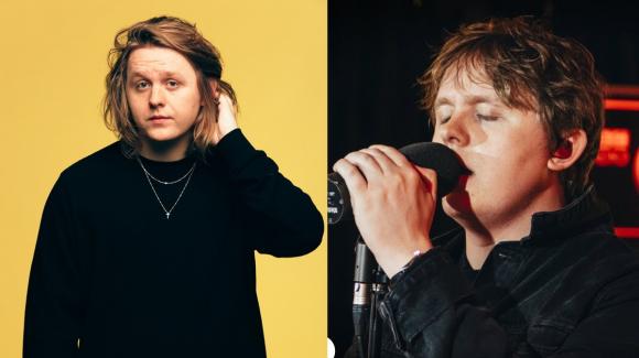 Lewis Capaldi svela: "Mi hanno diagnosticato la Sindrome di Tourette"