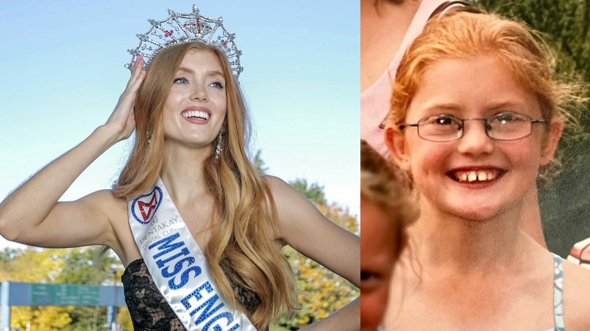 Da piccola era bullizzata per i suoi capelli, oggi Jessica Gagen è la ...