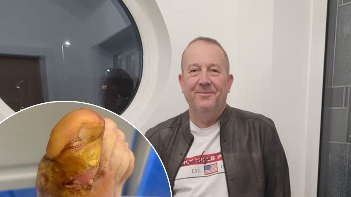 Va in crociera per l'anniversario ed un ragno depone le uova nel suo alluce