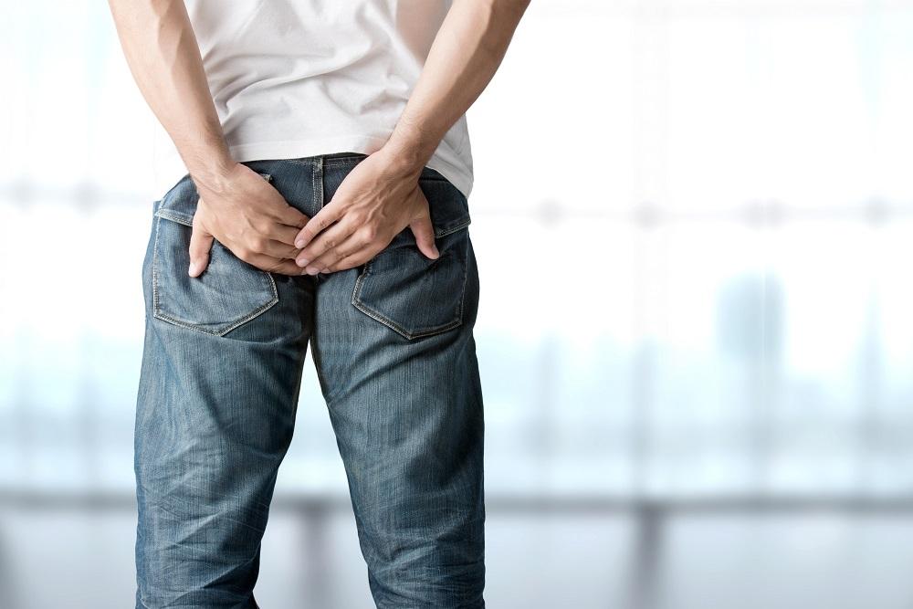 Fistola sacro coccigea e cisti pilonidale: cos'è, cura e intervento