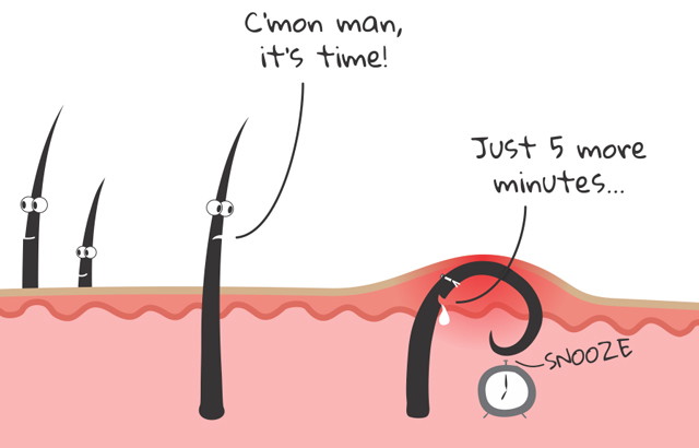 Peli incarniti: ecco quello che devi sapere