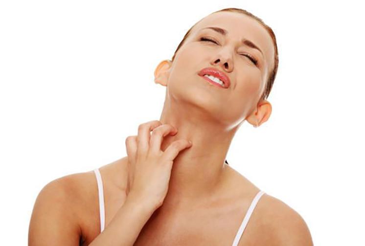 Orticaria da stress: quanto dura, i sintomi e i rimedi naturali