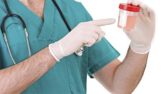 Sangue nelle urine o ematuria nelle donne: cause e rimedi
