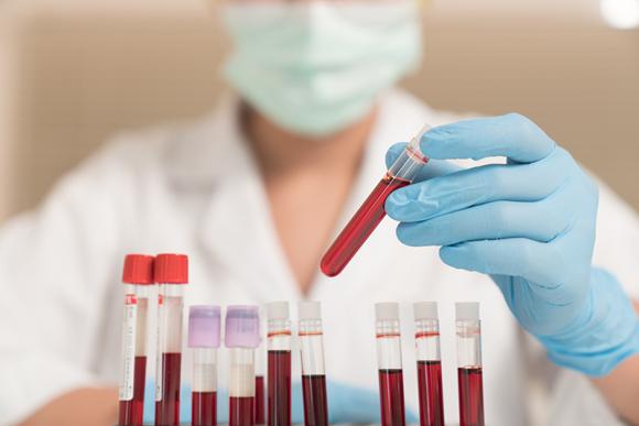 Morbo di Addison: sintomi, diagnosi e terapia da seguire