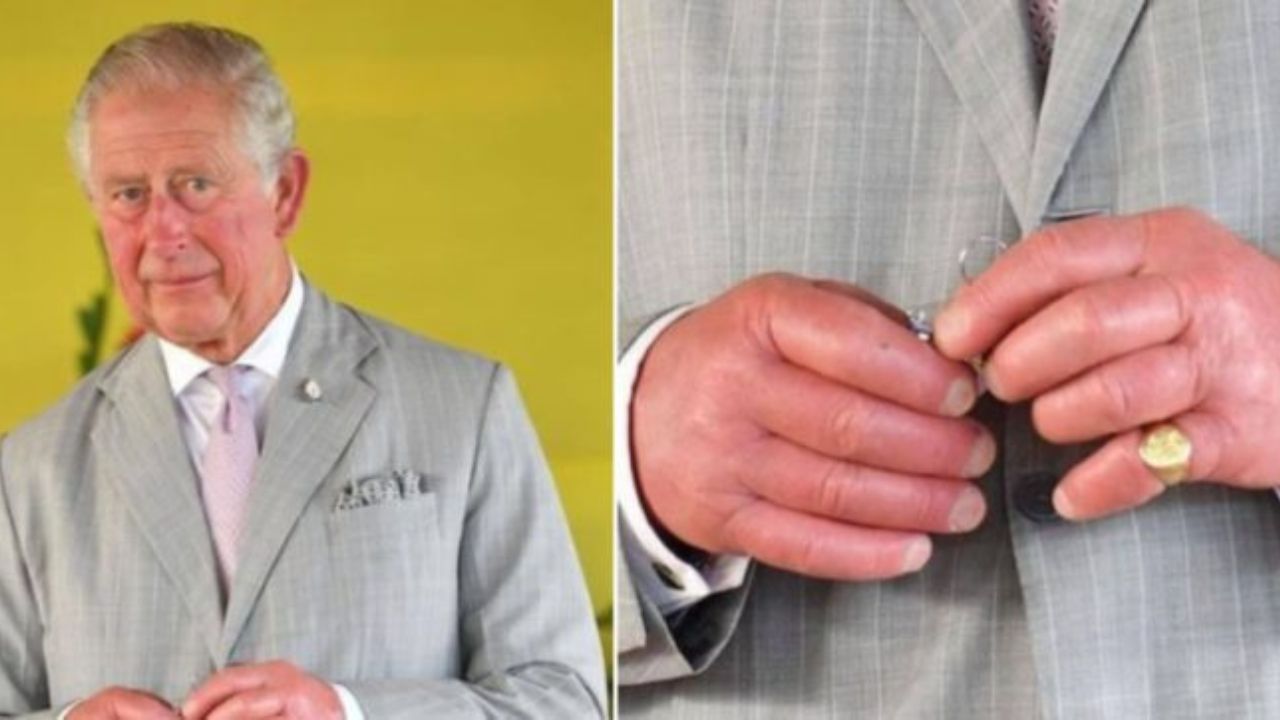 Re Carlo, mani gonfie e rosse: cosa è emerso dai medici