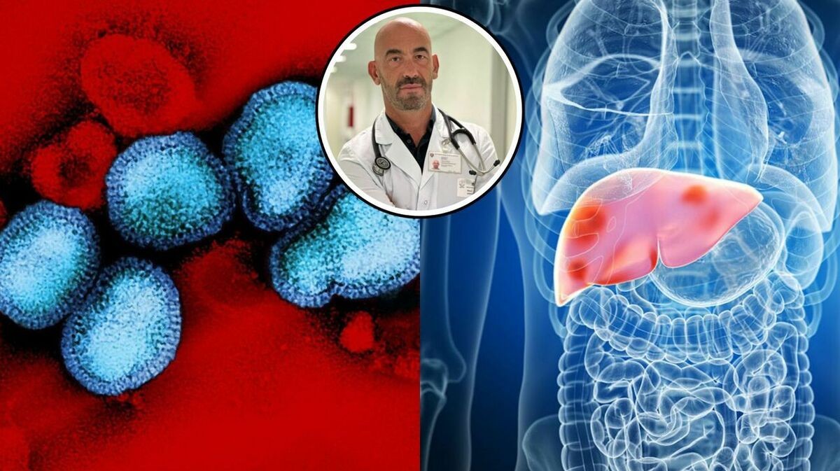 Allarme influenza australiana, il nuovo pesantissimo sintomo: cosa colpisce