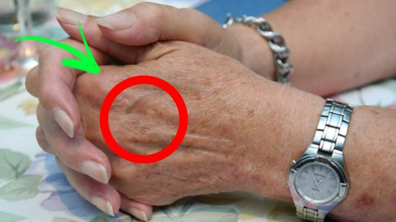 Cosa significa avere le macchie sulle mani