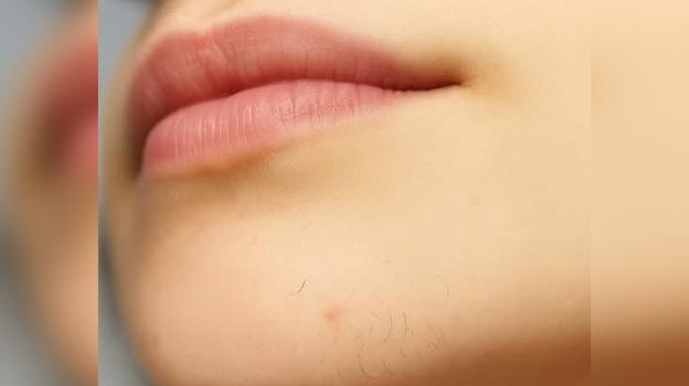 Perché le donne hanno i peli sul mento (e cosa fare per combatterli)