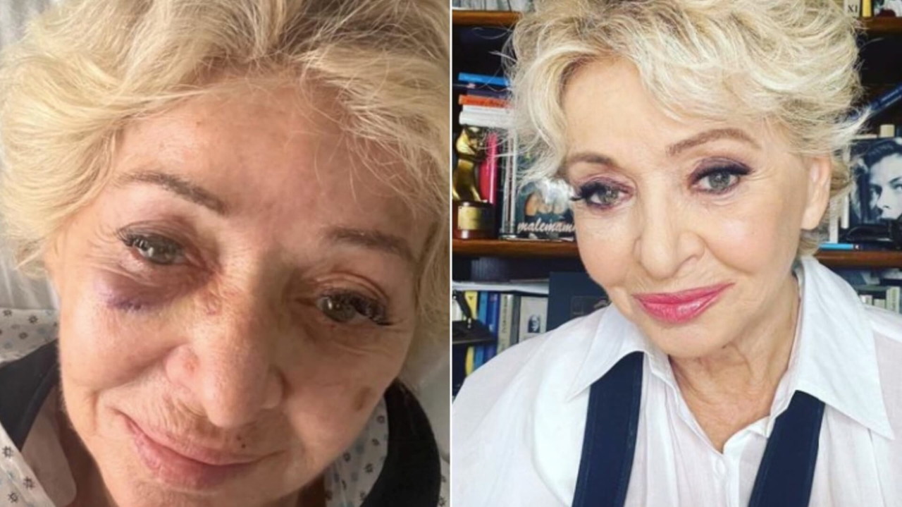 Enrica Bonaccorti rompe il silenzio: "Quanto mi resta.."